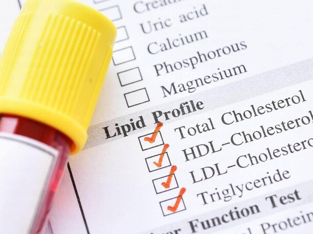 Xanthelasma (Cholesterol Eyes): Causes & Cosmetic Care